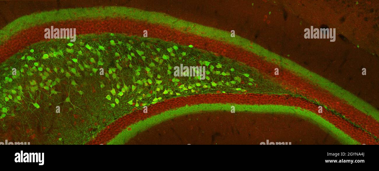 Section of mouse rostral hippocampus labelled with immunofluorescence ...