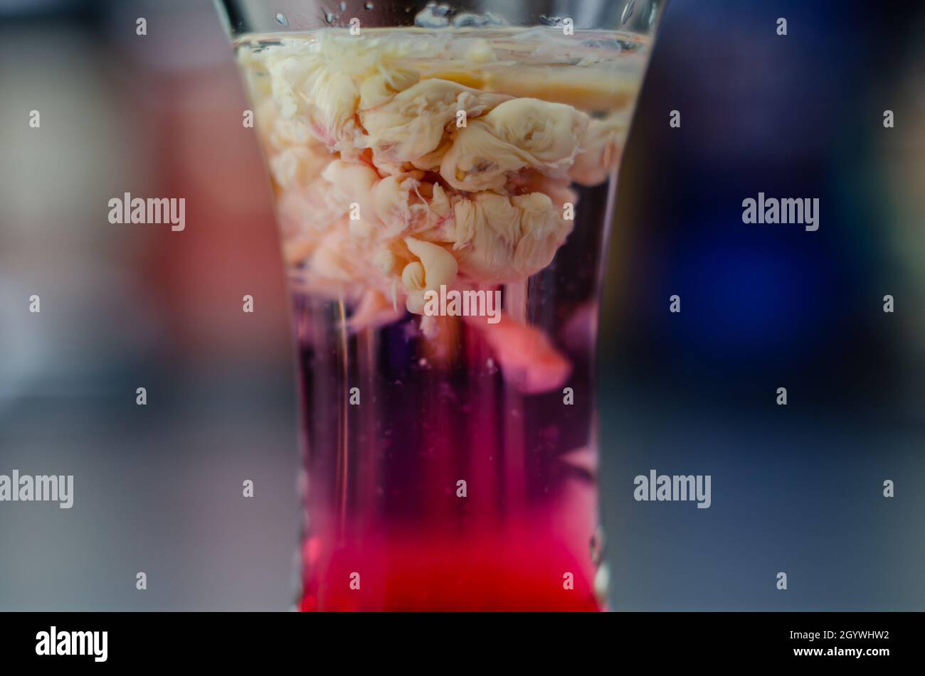 Brain hemorrhage cocktail hi-res stock photography and images - Alamy