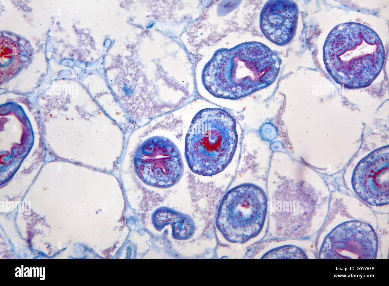 Hydatide cysts of tapeworm in dog, TS. brightfield photomicrograph ...