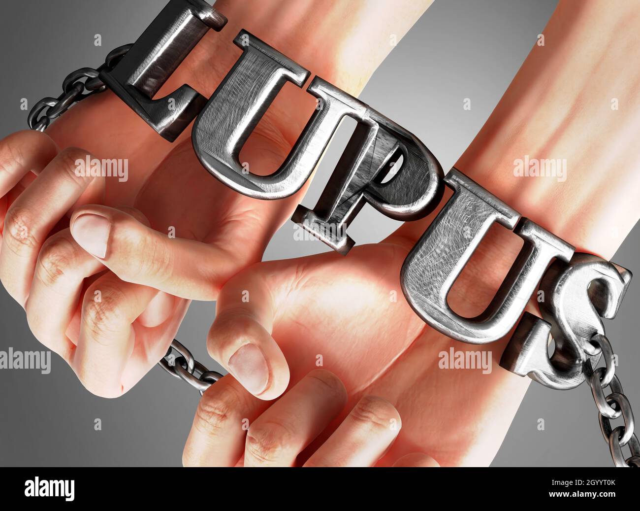 Lupus, social impact and its influence - a concept showing a person's ...