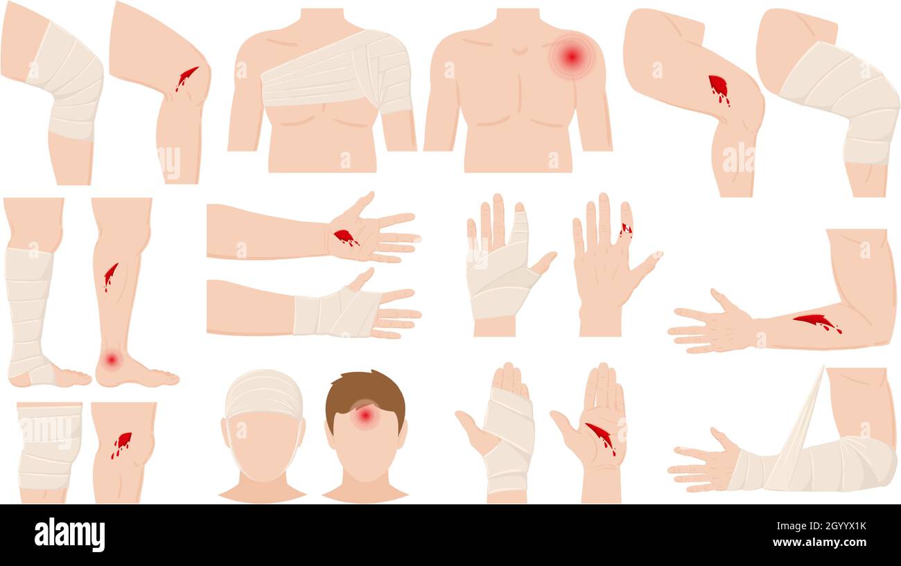 Cartoon physical injury, wound bandage application concept. Open and bandaged human body parts ...