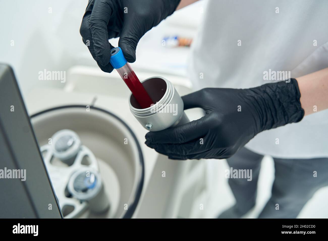 Medical laboratory worker holding test tube with blood Stock Photo - Alamy