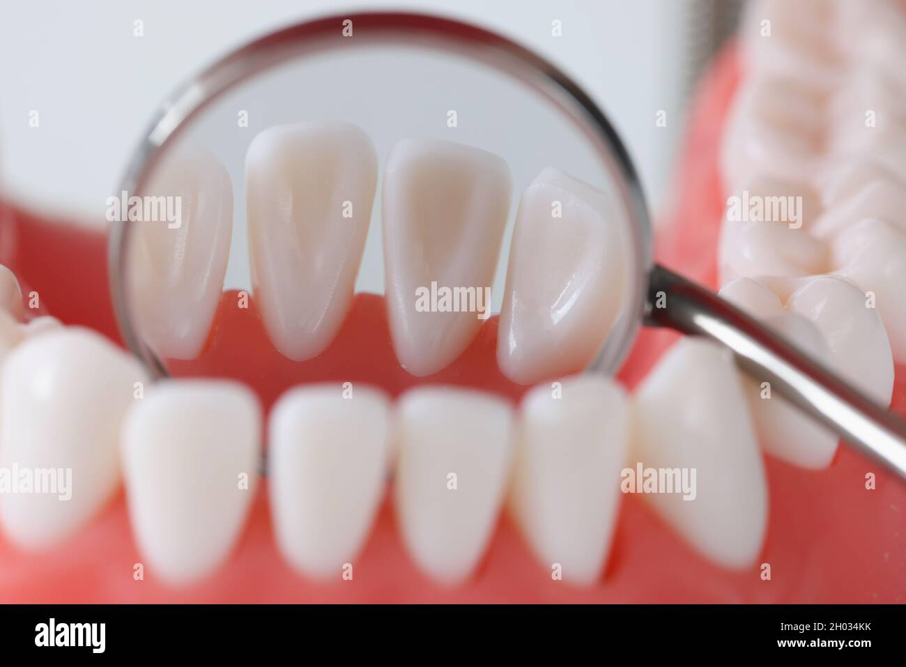 Viewing teeth from inside with dental mirror closeup Stock Photo - Alamy