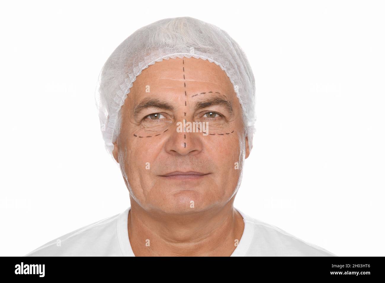 Man face surgery marks hi-res stock photography and images - Alamy