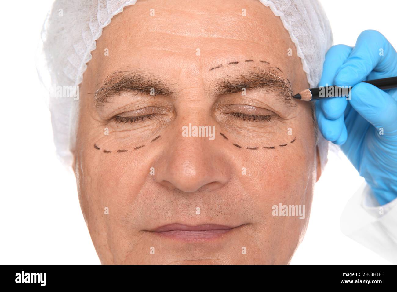 Doctor marking senior man face before cosmetic surgery on white ...