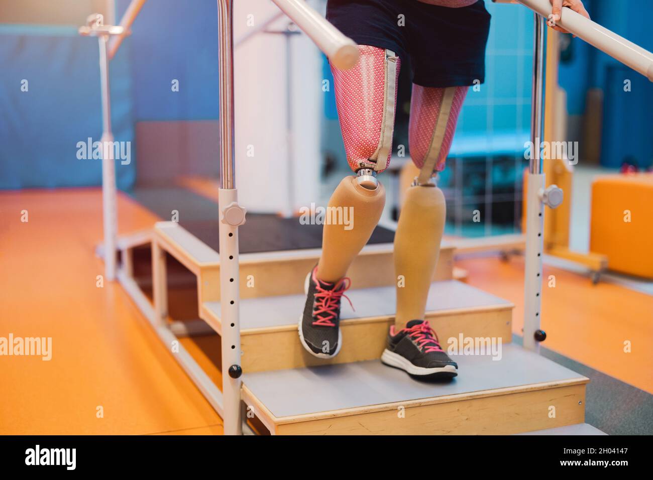 Young woman with prosthetic legs exercising at physiotherapy center ...