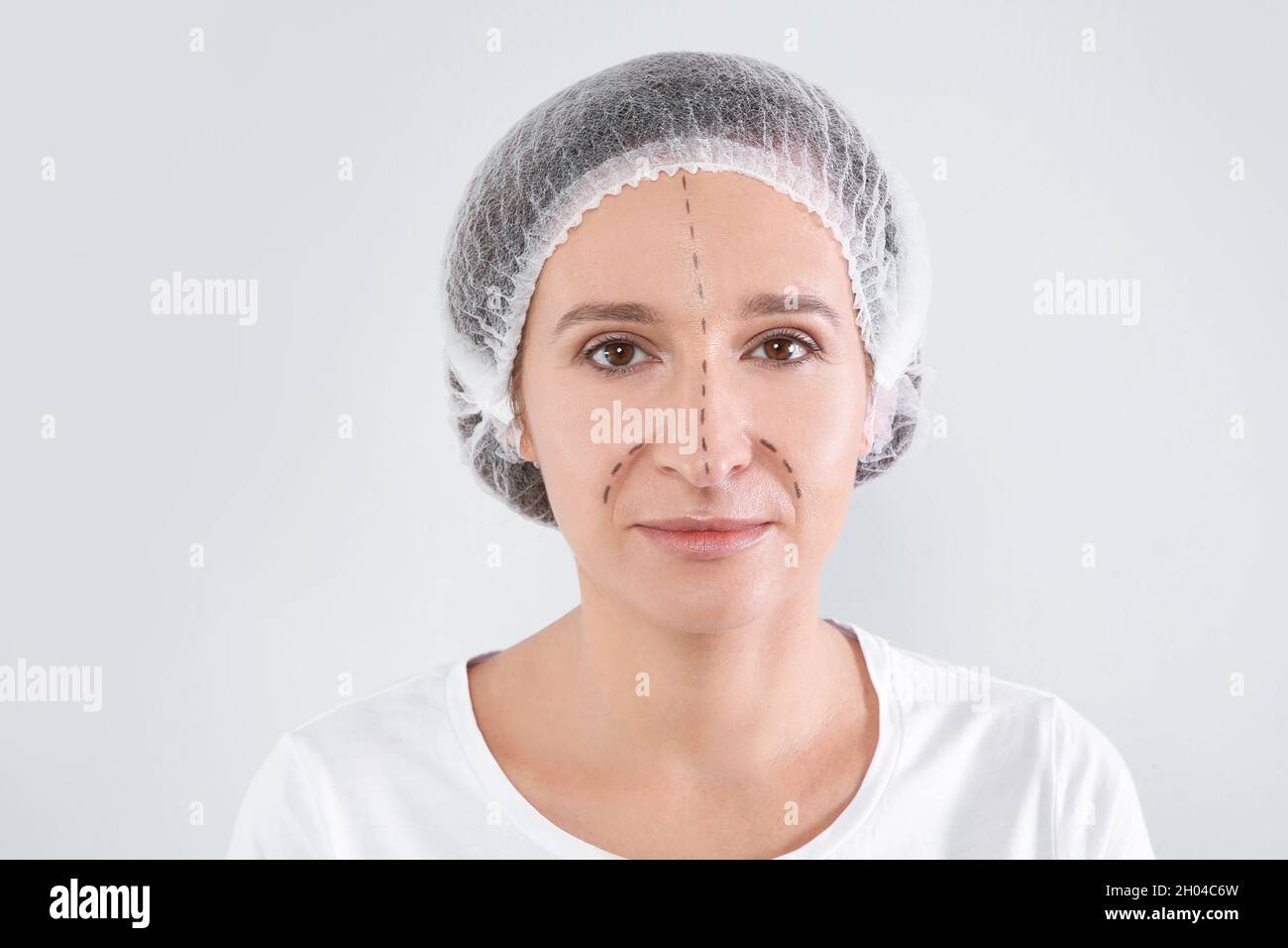 Portrait of mature woman with marks on face preparing for cosmetic ...