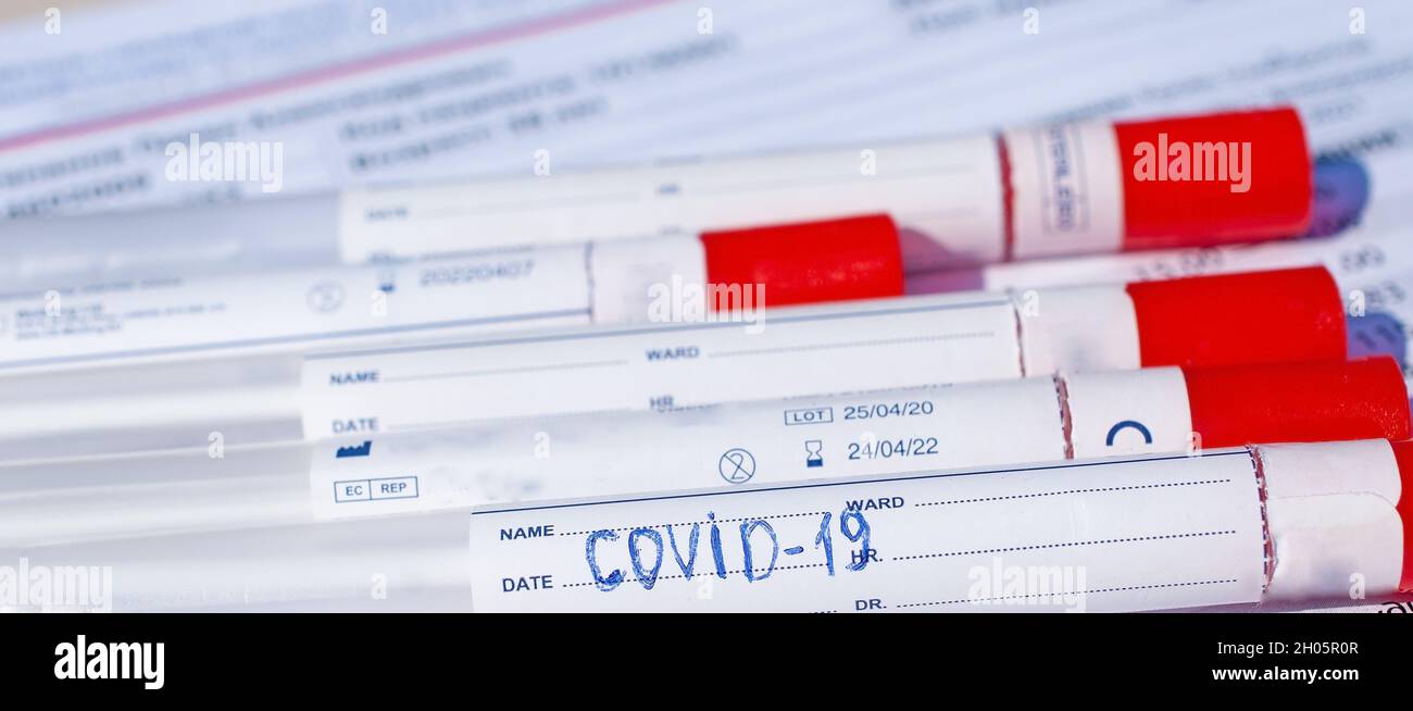 Test tubes and results of biochemical tests for viruses and bacteria ...