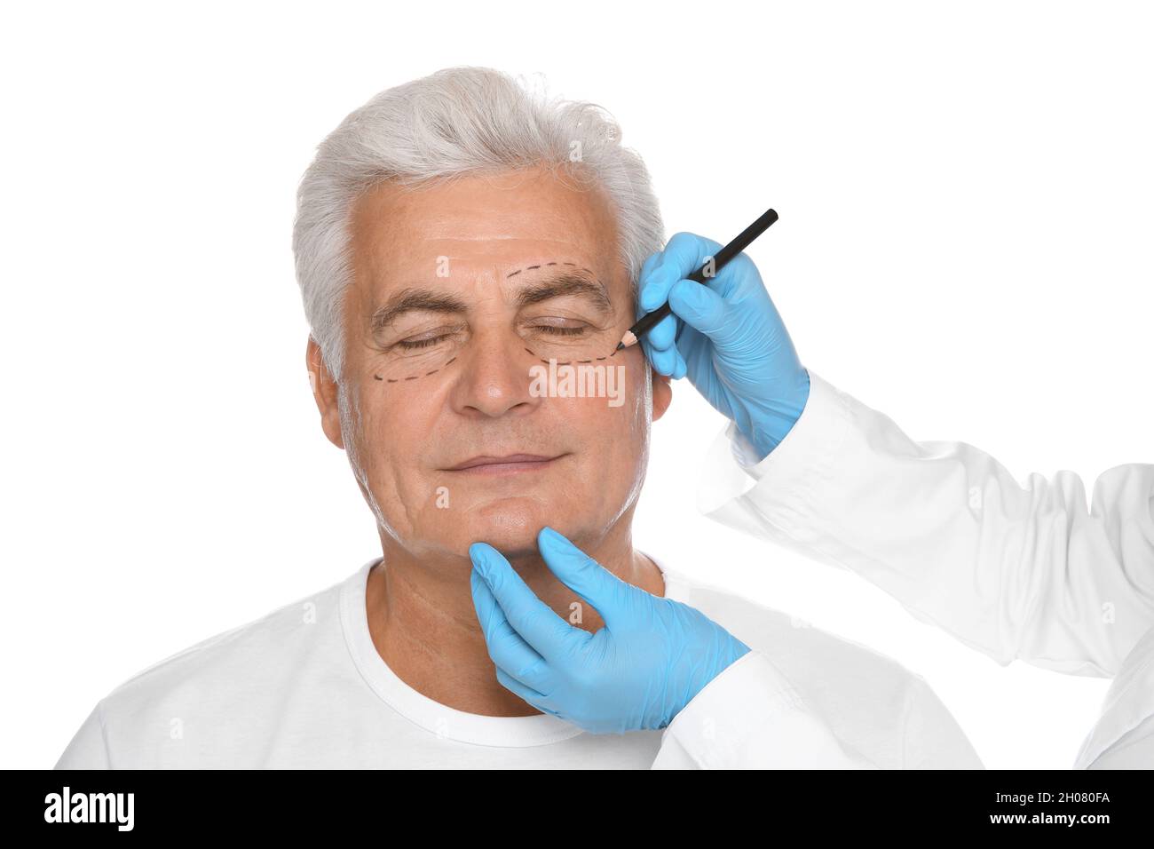 Cosmetic surgery face marks man hi-res stock photography and images - Alamy