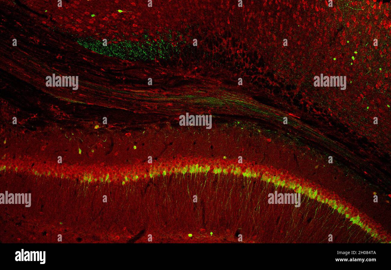 Confocal microscopy image of immunofluorescence- labelled cells in the ...