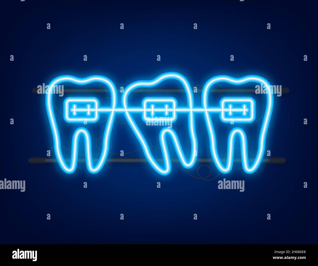 Correction of teeth with orthodontic braces. Stages of teeth alignment ...