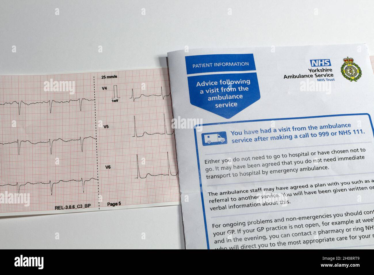 ECG printout from a patient visit, by ambulance first responders Stock ...