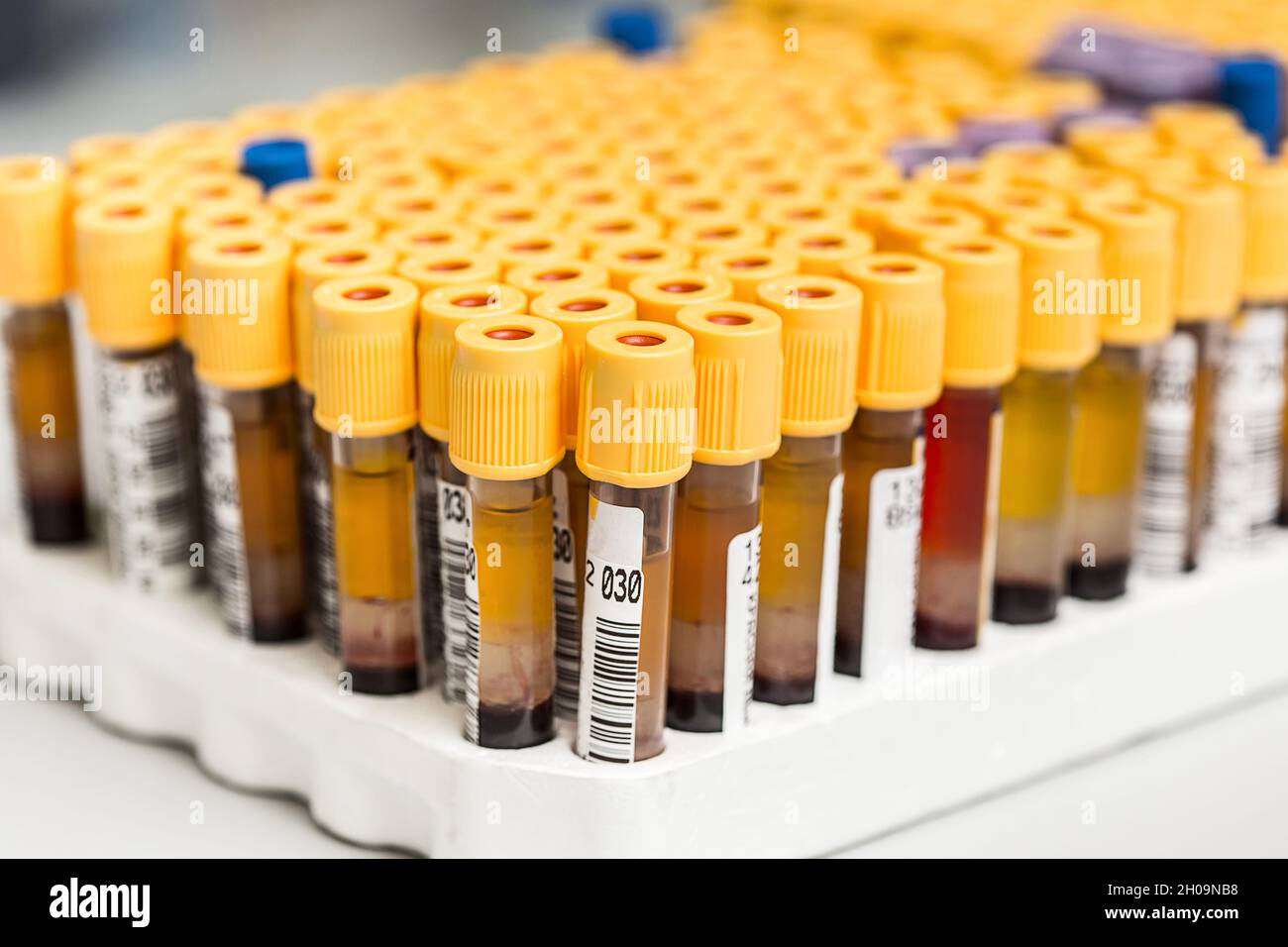 Test-tubes with yellow liquid in the laboratory Stock Photo - Alamy