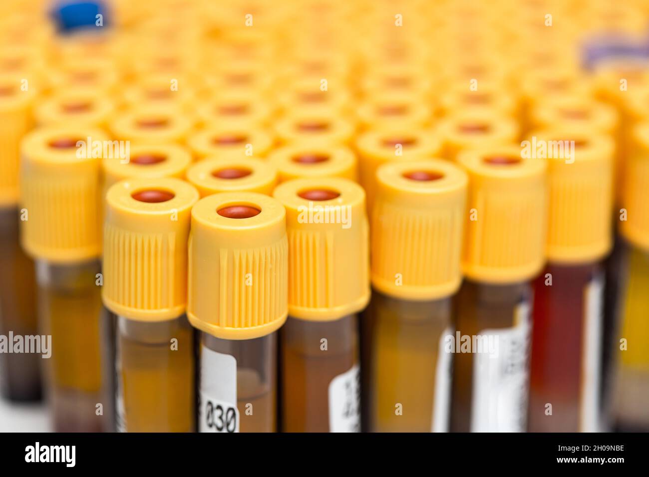 Plastic holder test tubes hi-res stock photography and images - Alamy