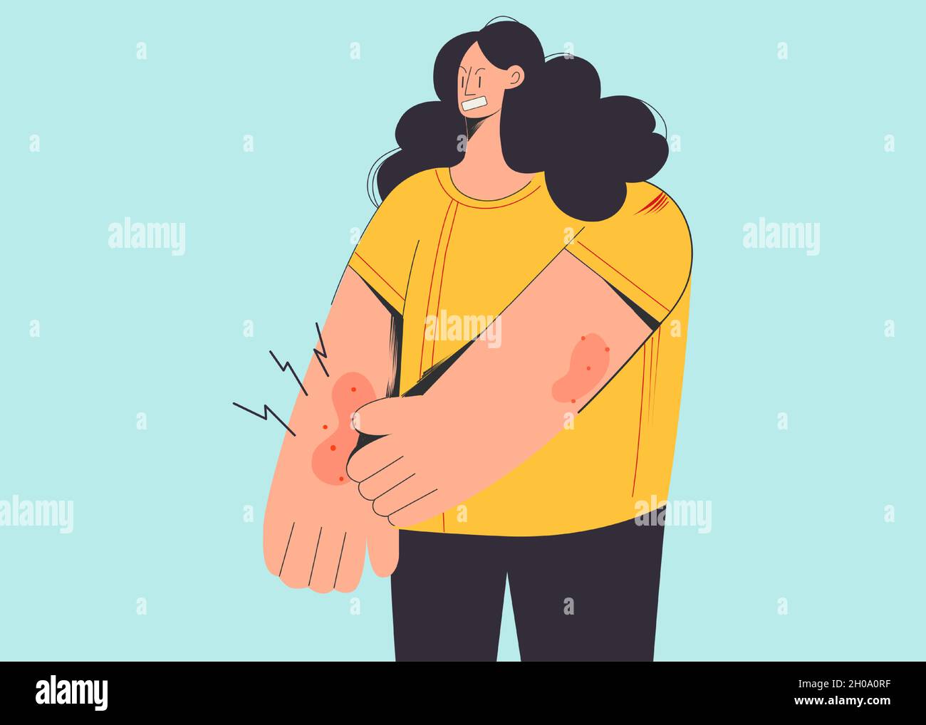 Psoriasis cartoon hi-res stock photography and images - Alamy