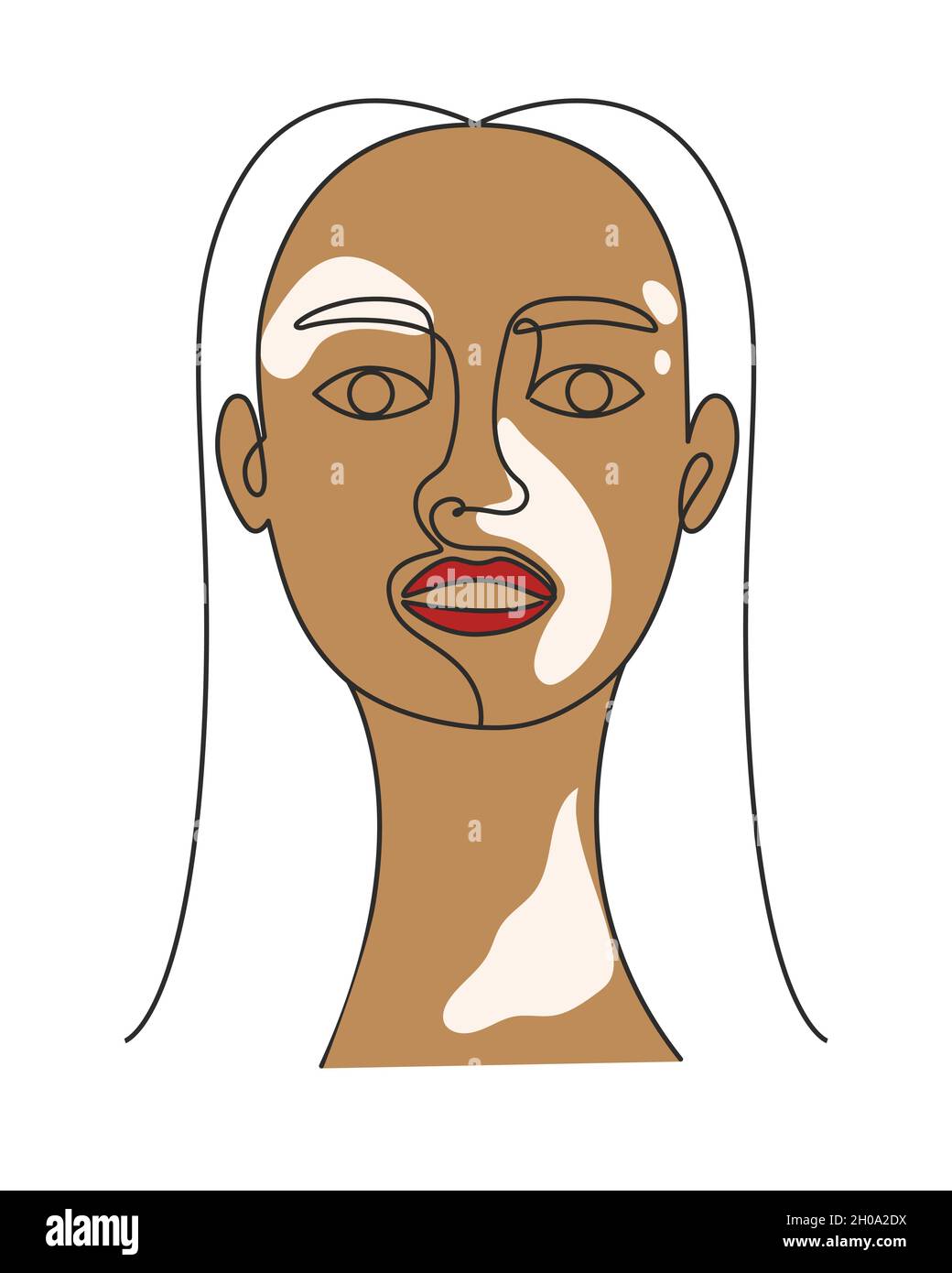 Portrait of a woman with vitiligo line art vector illustration. Adult ...