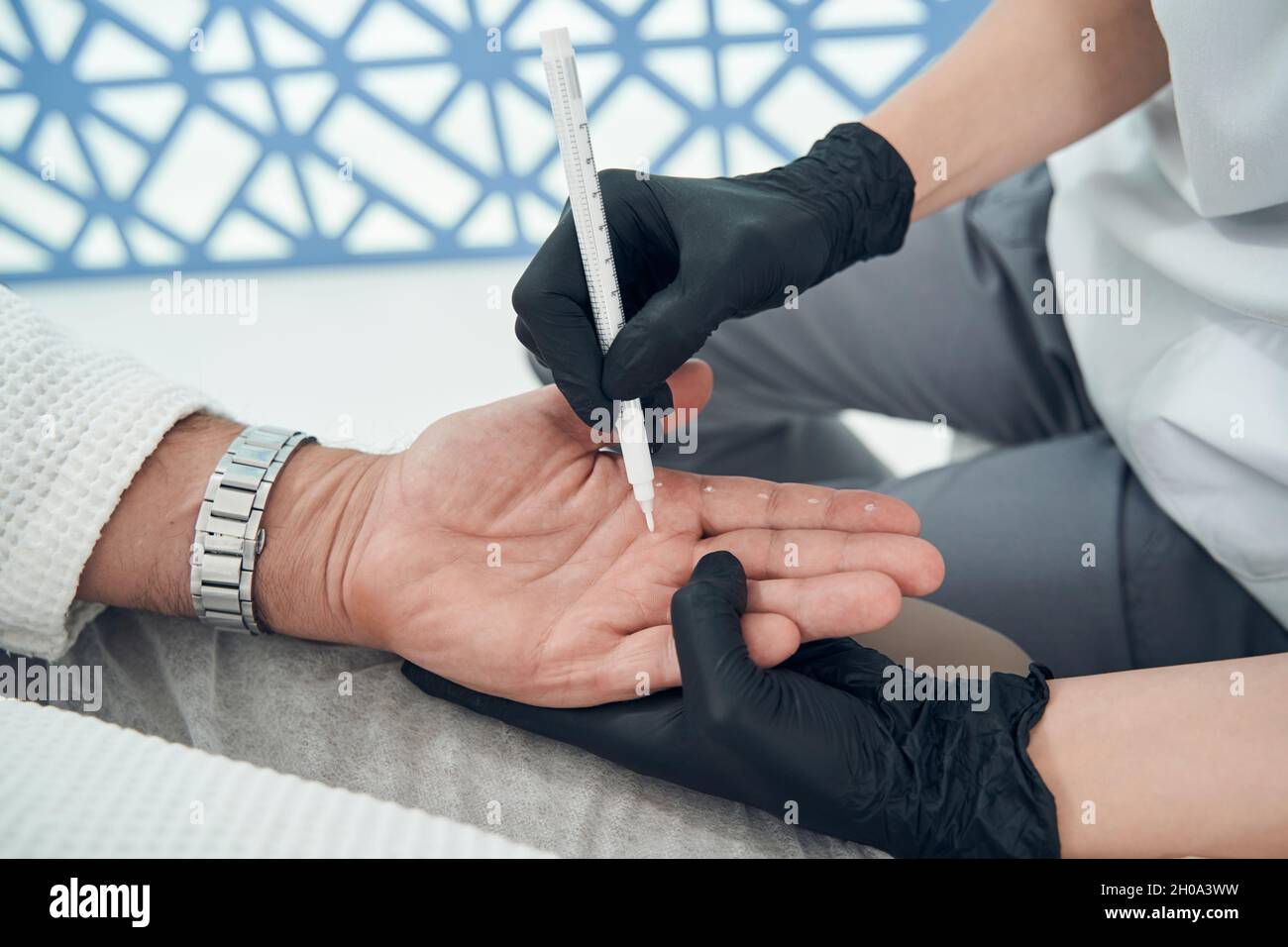 Cosmetologist marking man hand before cosmetic procedure Stock Photo ...