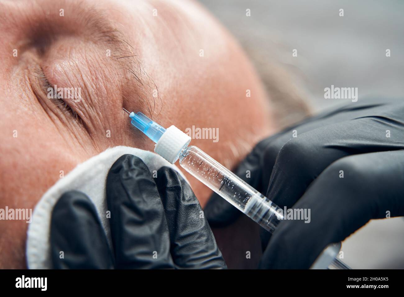 Beautician hands making injection into male eyelid Stock Photo - Alamy