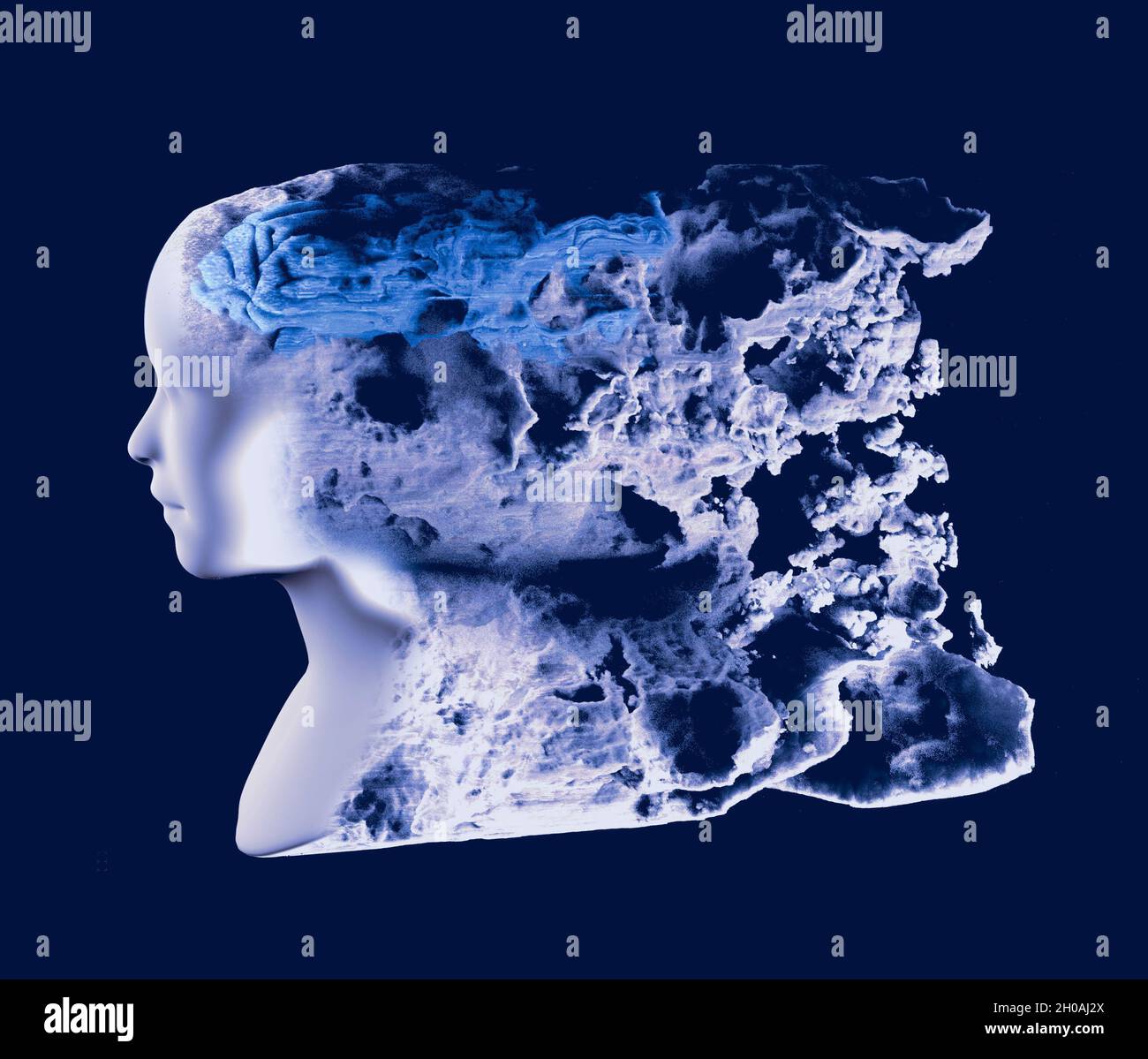 Memory lapses, forgetting things, degenerative disease. Brain problems ...