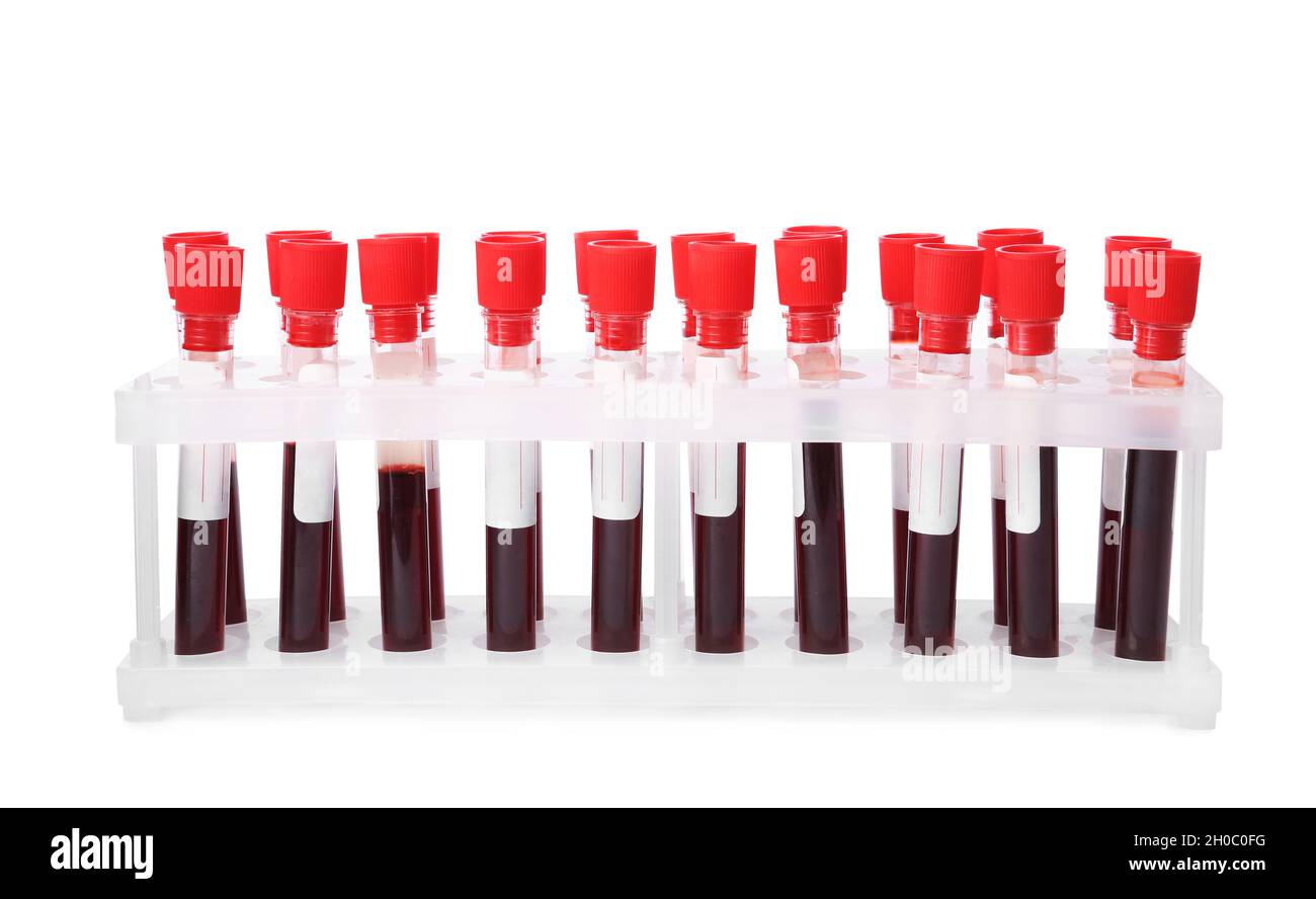 Test tubes with blood samples in rack isolated on white. Laboratory ...
