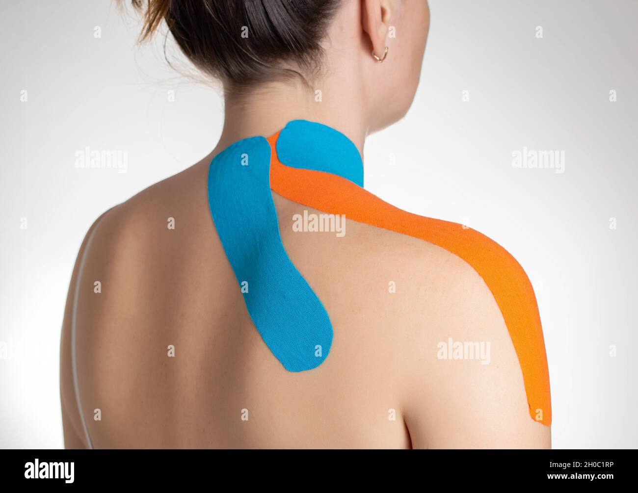 Fixation of muscles and ligaments on the girl's shoulder with blue and ...