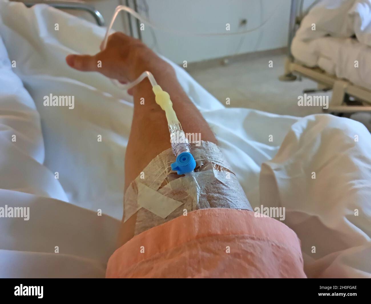 Peripheral venous catheter in the vein of human hand. Medical therapy ...