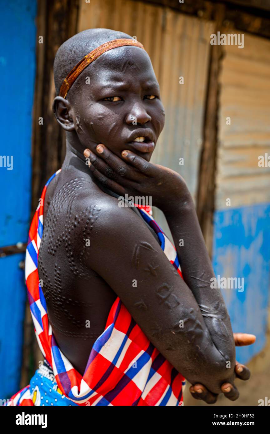 Body scars hi-res stock photography and images - Alamy