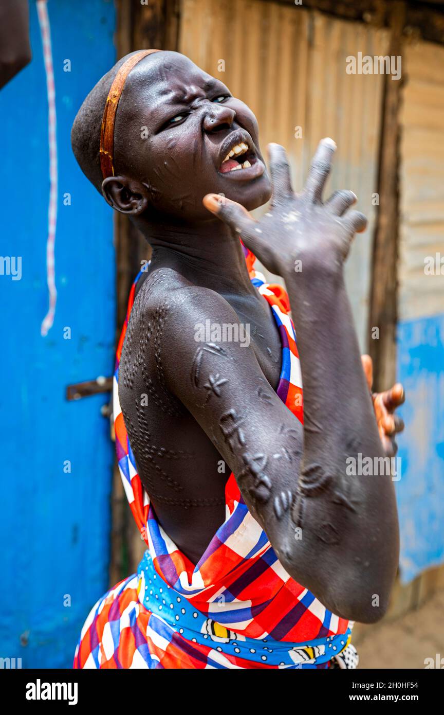 Girl with scar hi-res stock photography and images - Alamy
