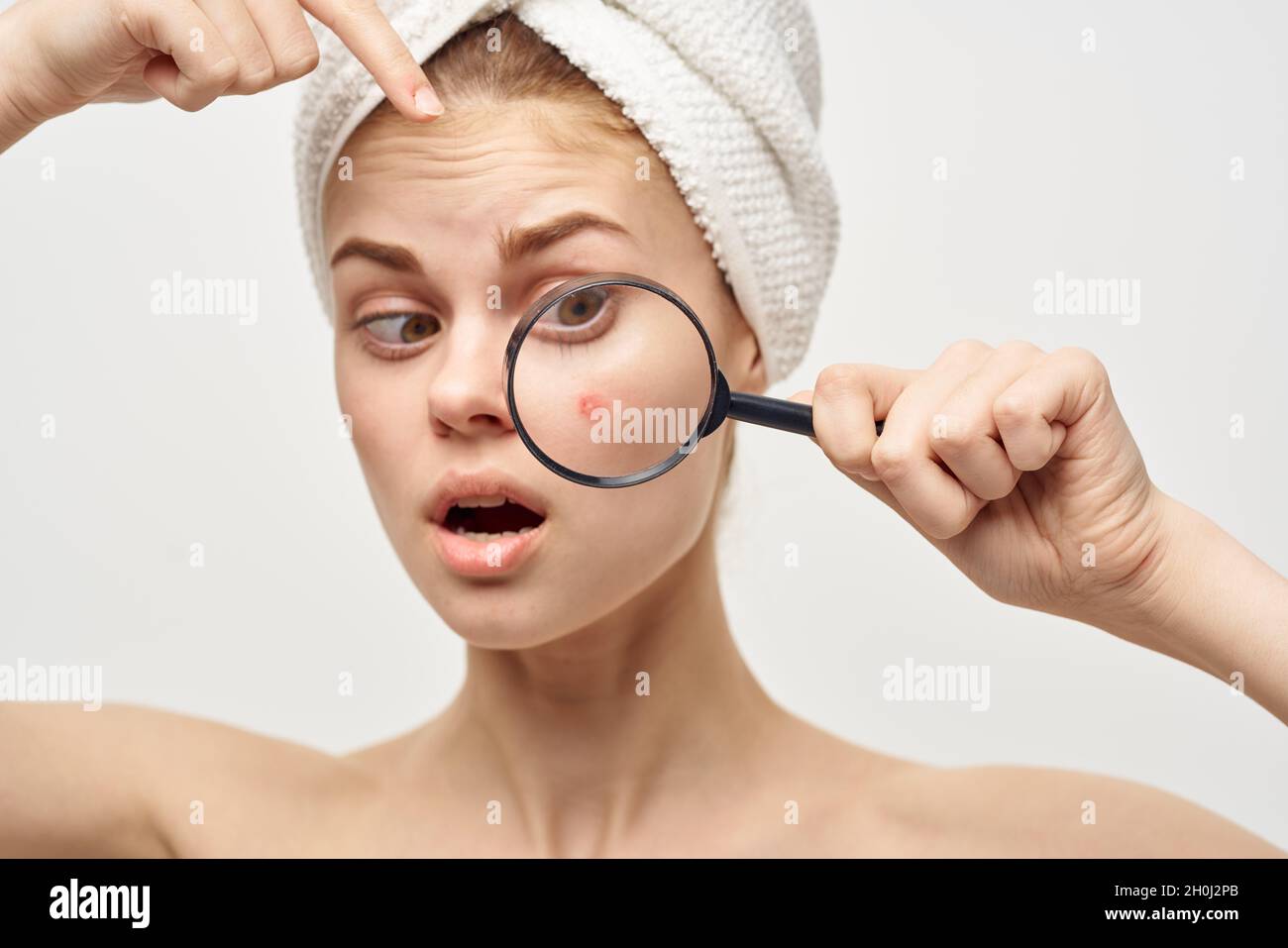 beautiful woman with a magnifying glass in hand skin problems Stock ...