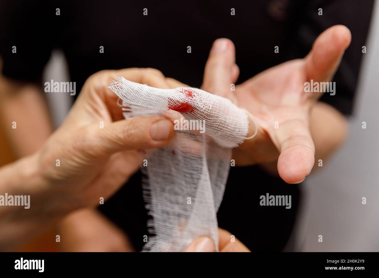 Sliced Hand Traumatic Injury