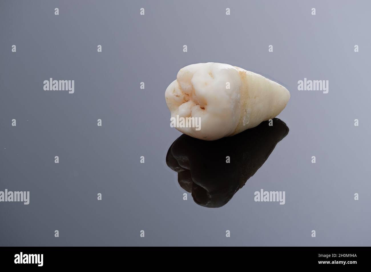 Closeup of a pulled wisdom tooth on the gray surface Stock Photo - Alamy