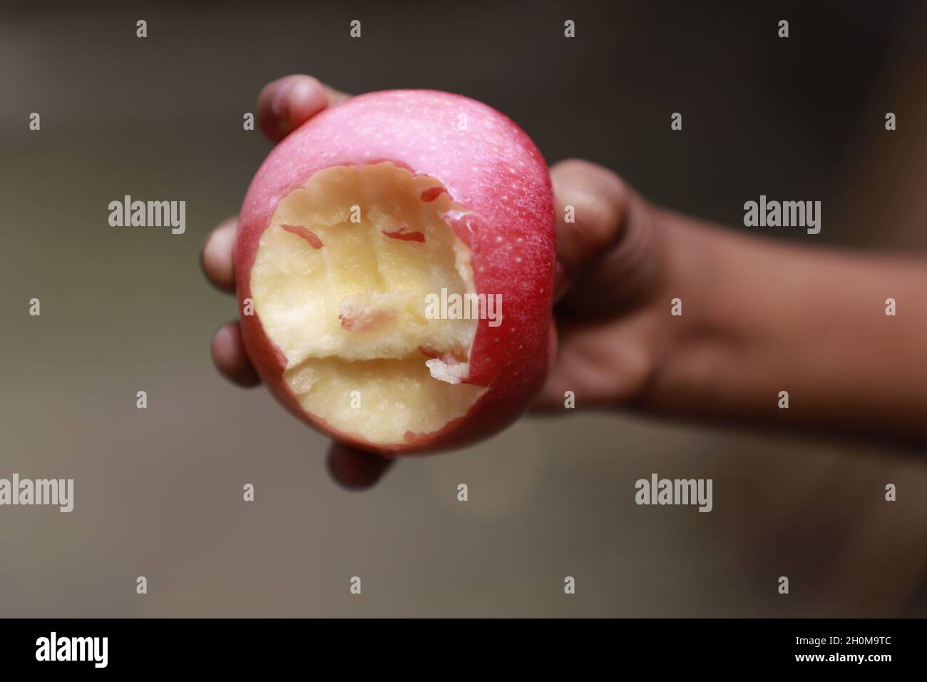 Bitten hand hi-res stock photography and images - Alamy