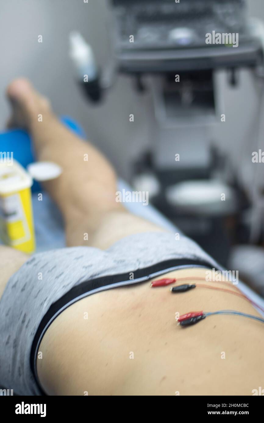 EPI Intratissue Percutaneous Electrolysis dry needling physical therapy lower back pain medical ...