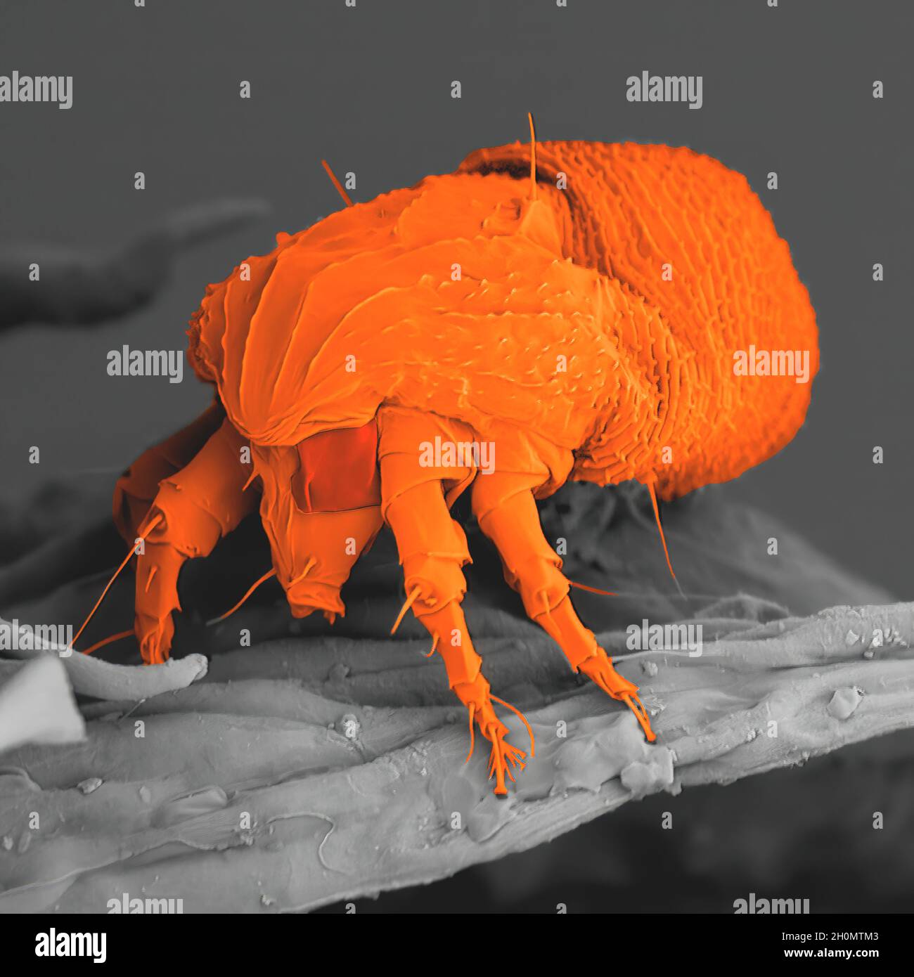 Rust mite observed in a scanning electron microscope Stock Photo - Alamy