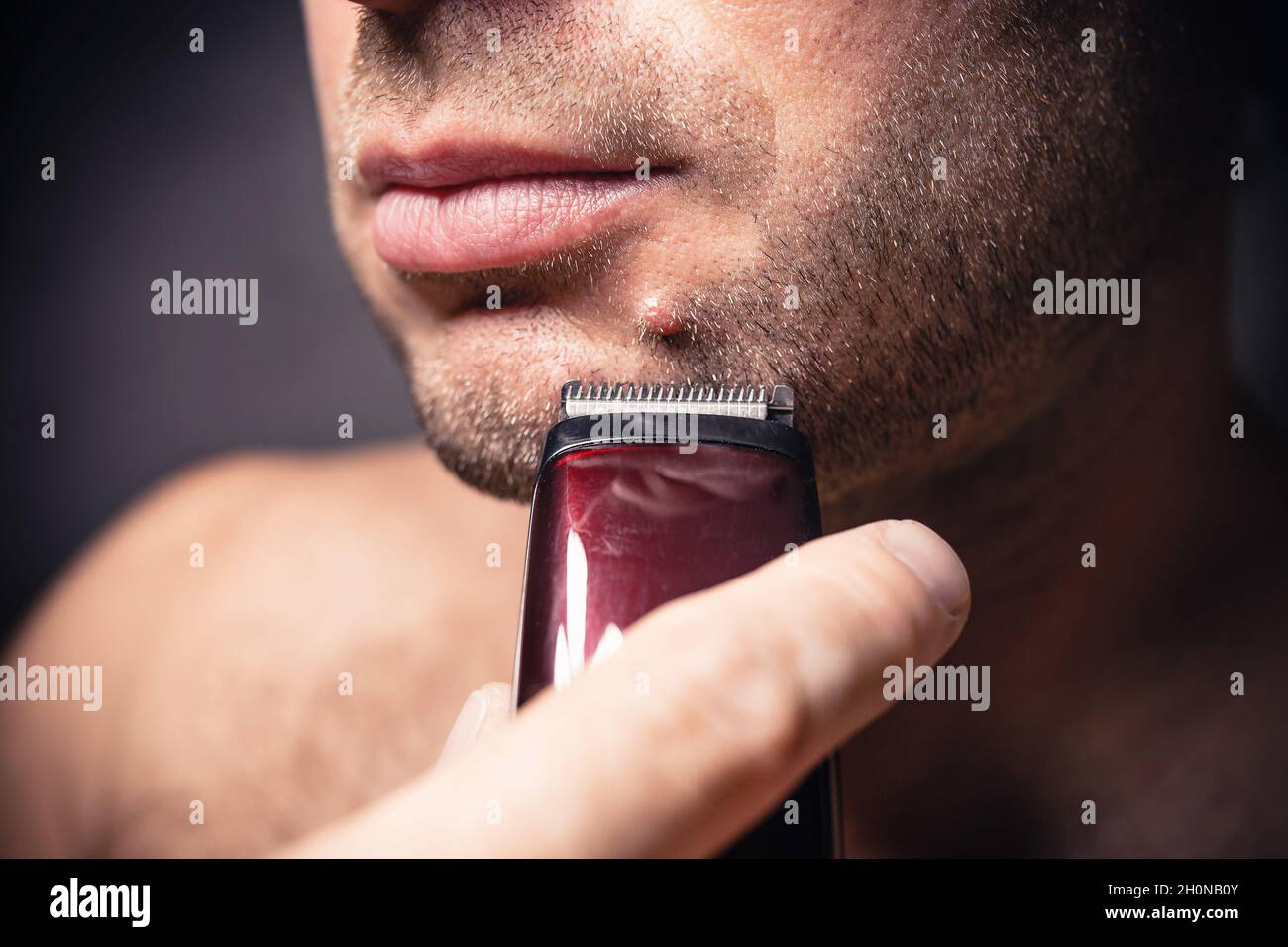 A large mole on the chin is an obstacle to shaving - the danger of ...