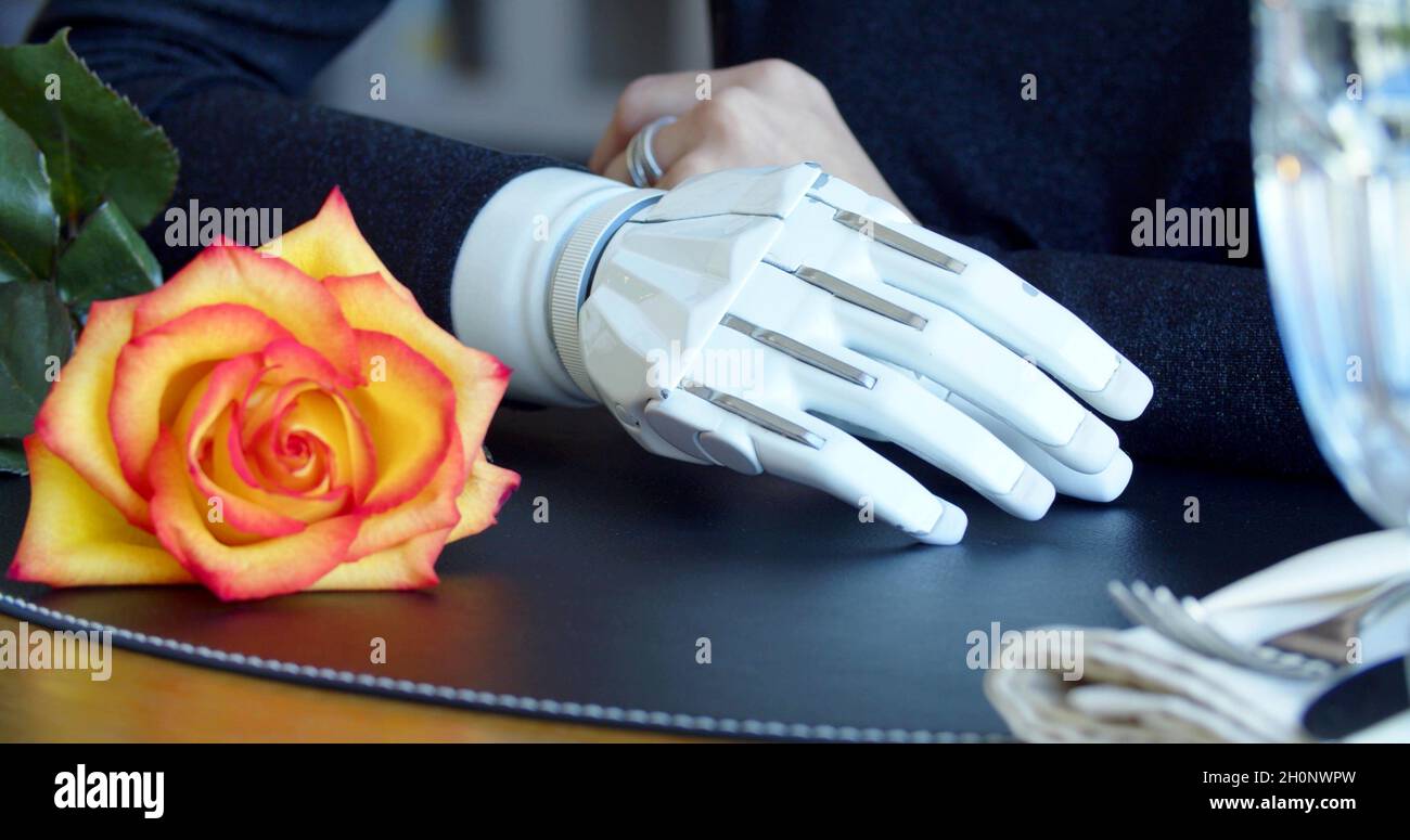 A photo of a hand prosthesis Stock Photo - Alamy