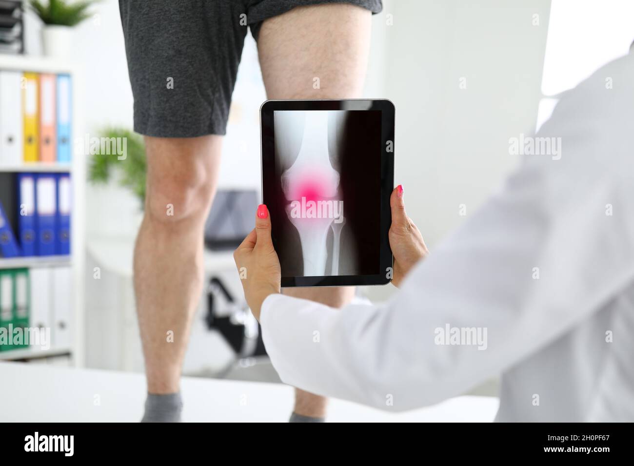 Arthrosis x ray hi-res stock photography and images - Alamy