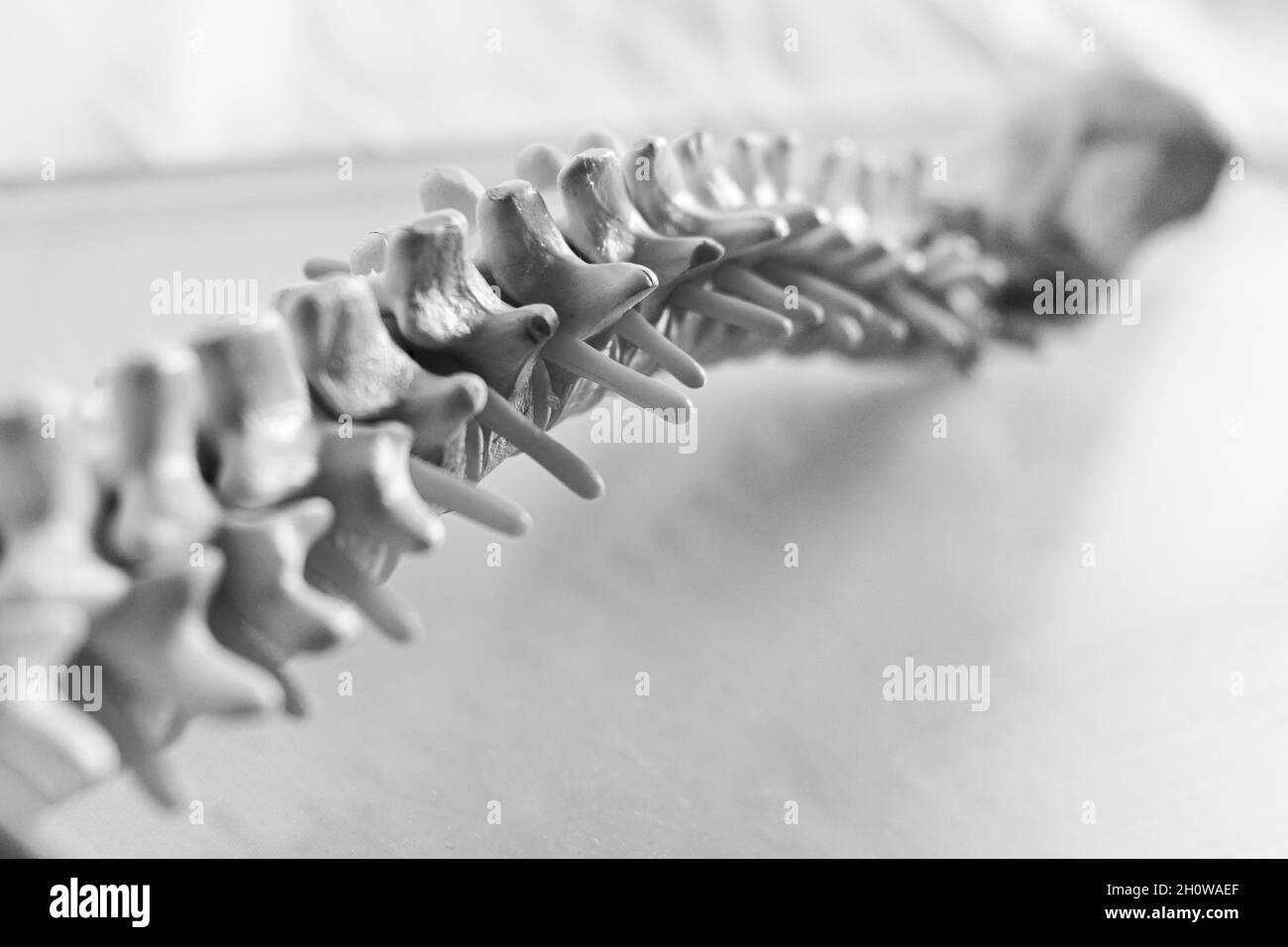 Spinal curvature hi-res stock photography and images - Alamy