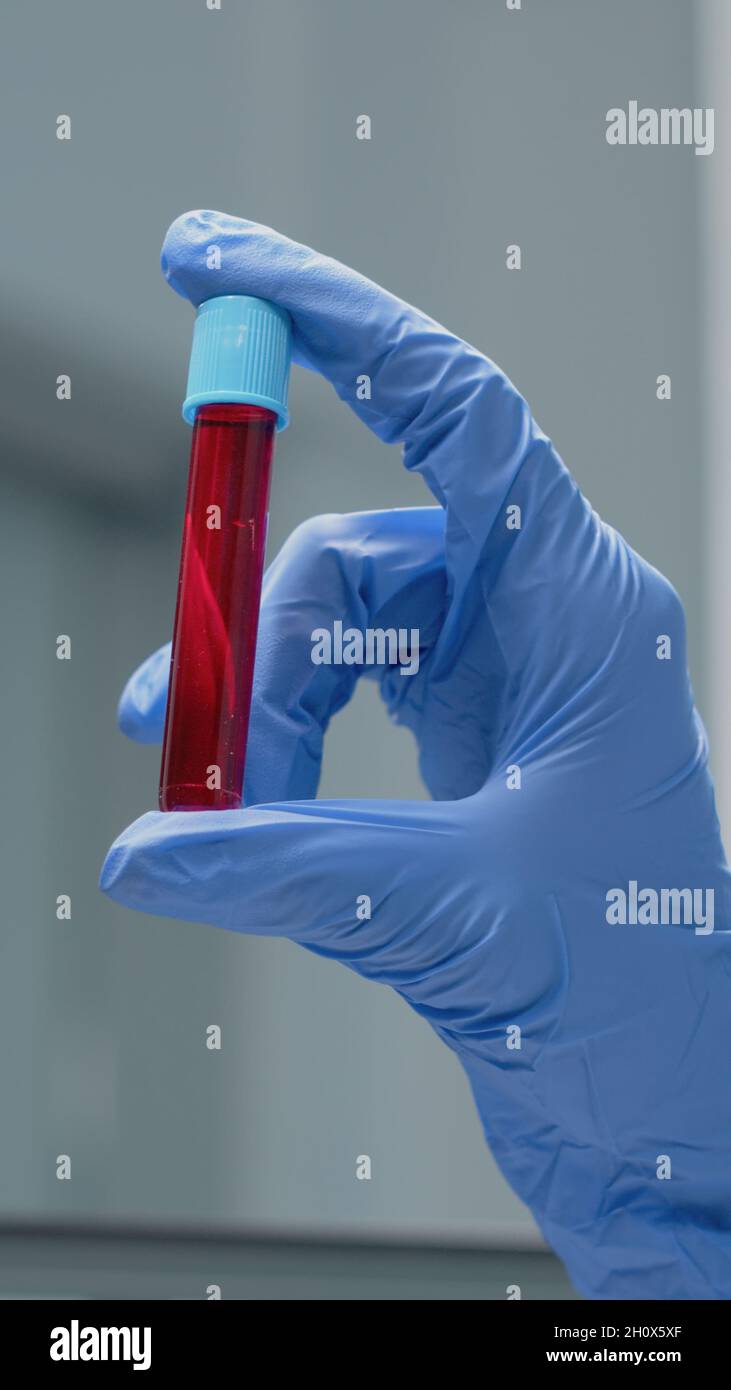 Hand holding solution in beaker hi-res stock photography and images - Alamy
