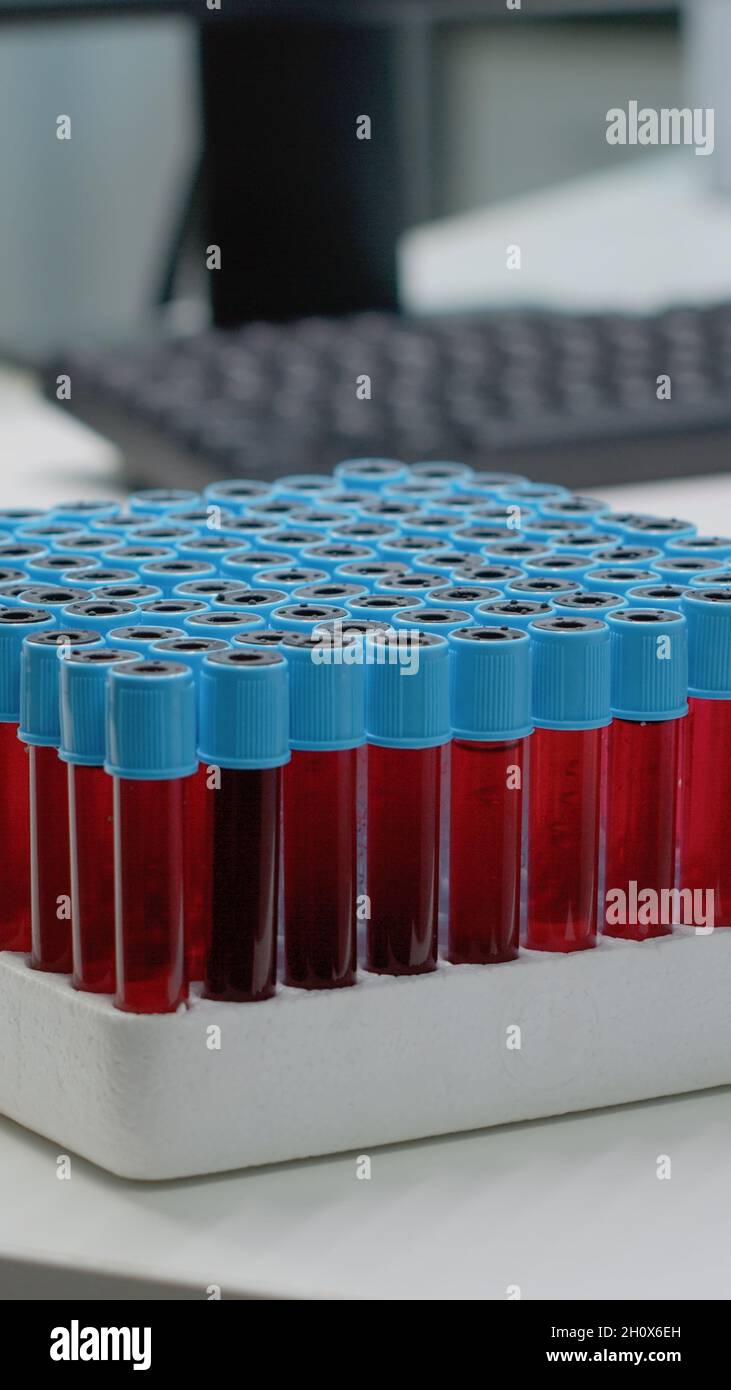 Vacutainer blood bottles hi-res stock photography and images - Alamy