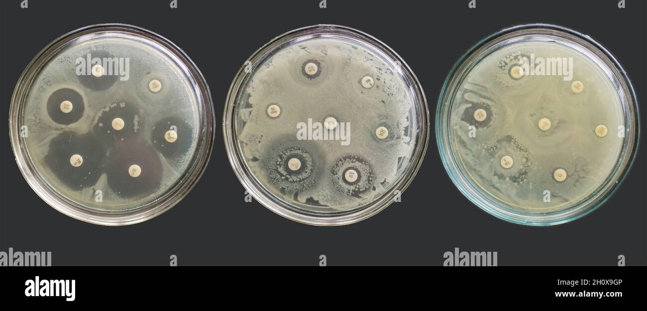 Bacterial resistance plate hi-res stock photography and images - Alamy