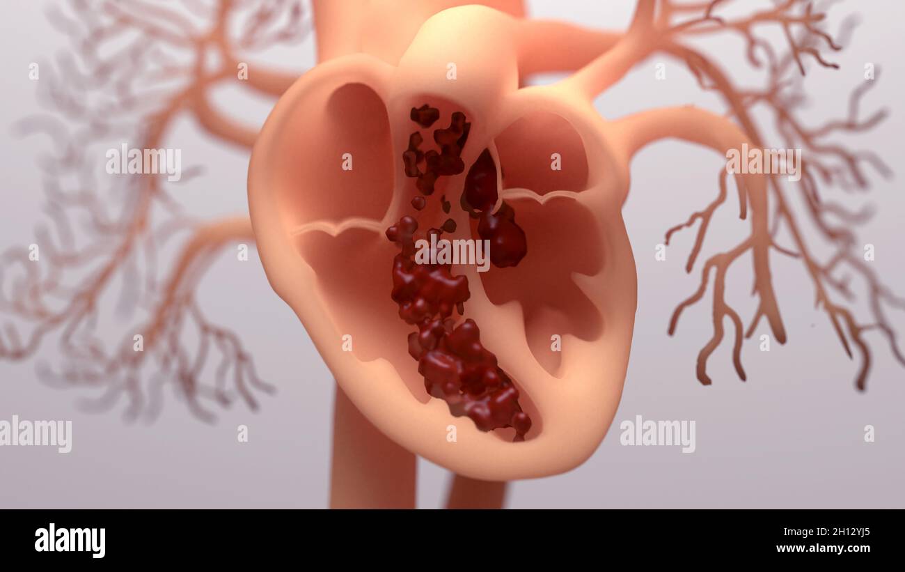 Blood pumping around a human heart, illustration Stock Photo - Alamy