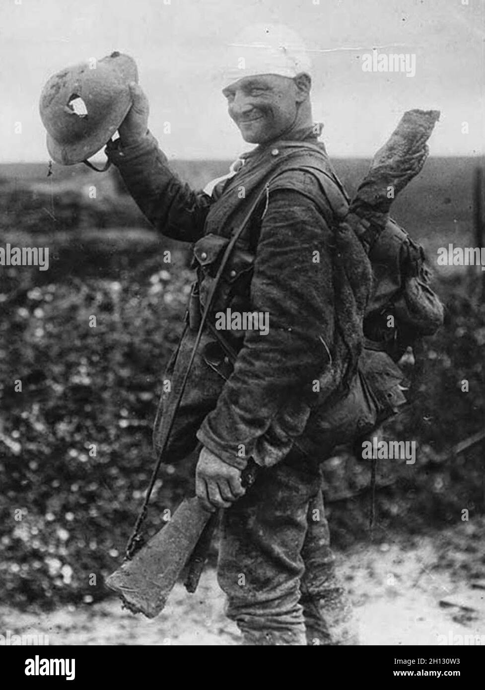 A soldier with a superficial head wound proudly shows his damaged ...