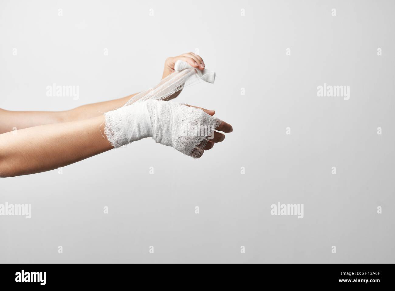 hand injury bandaging close-up medicine Stock Photo - Alamy