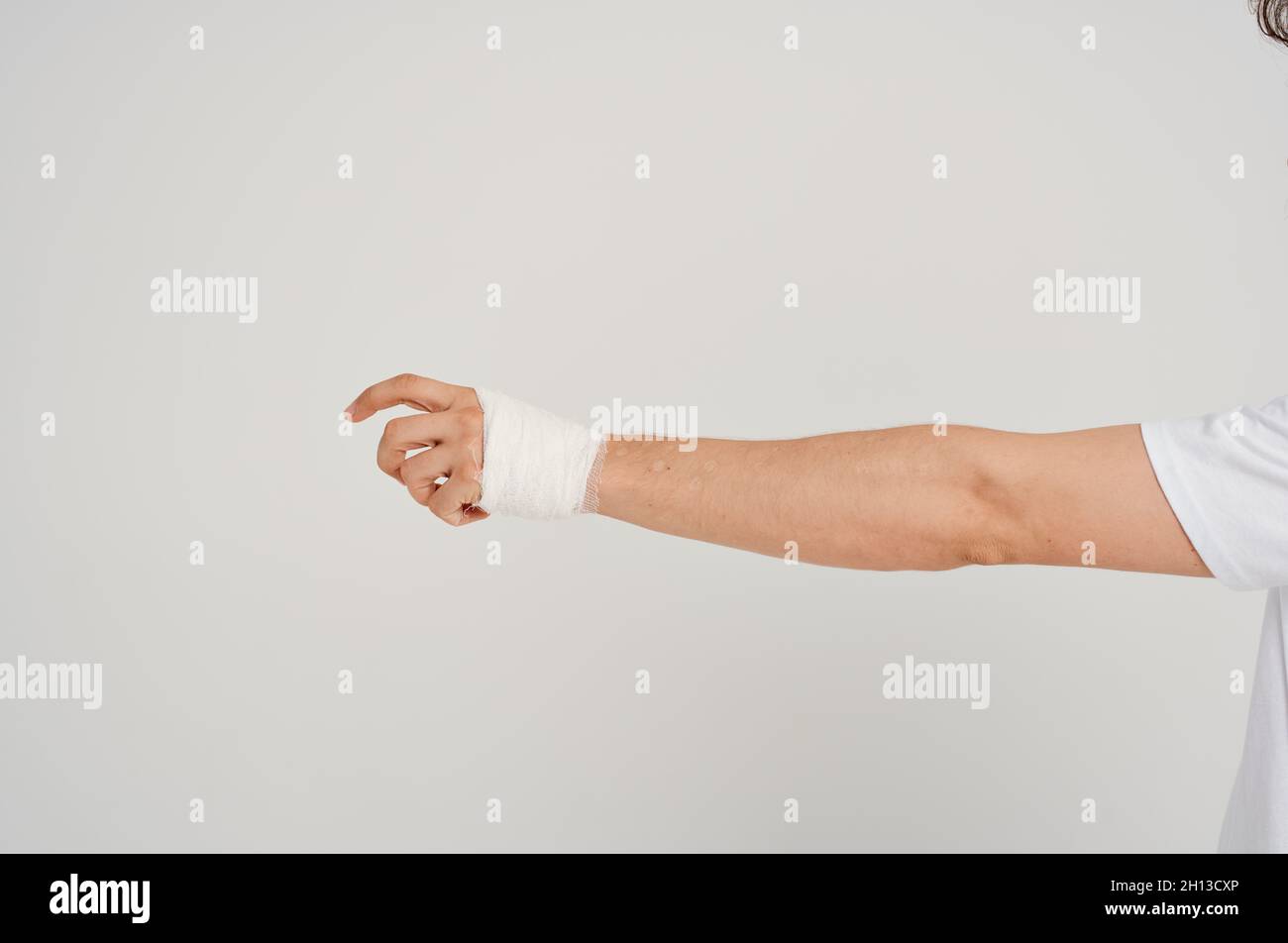 bandaged arm health problems pain injury Stock Photo - Alamy