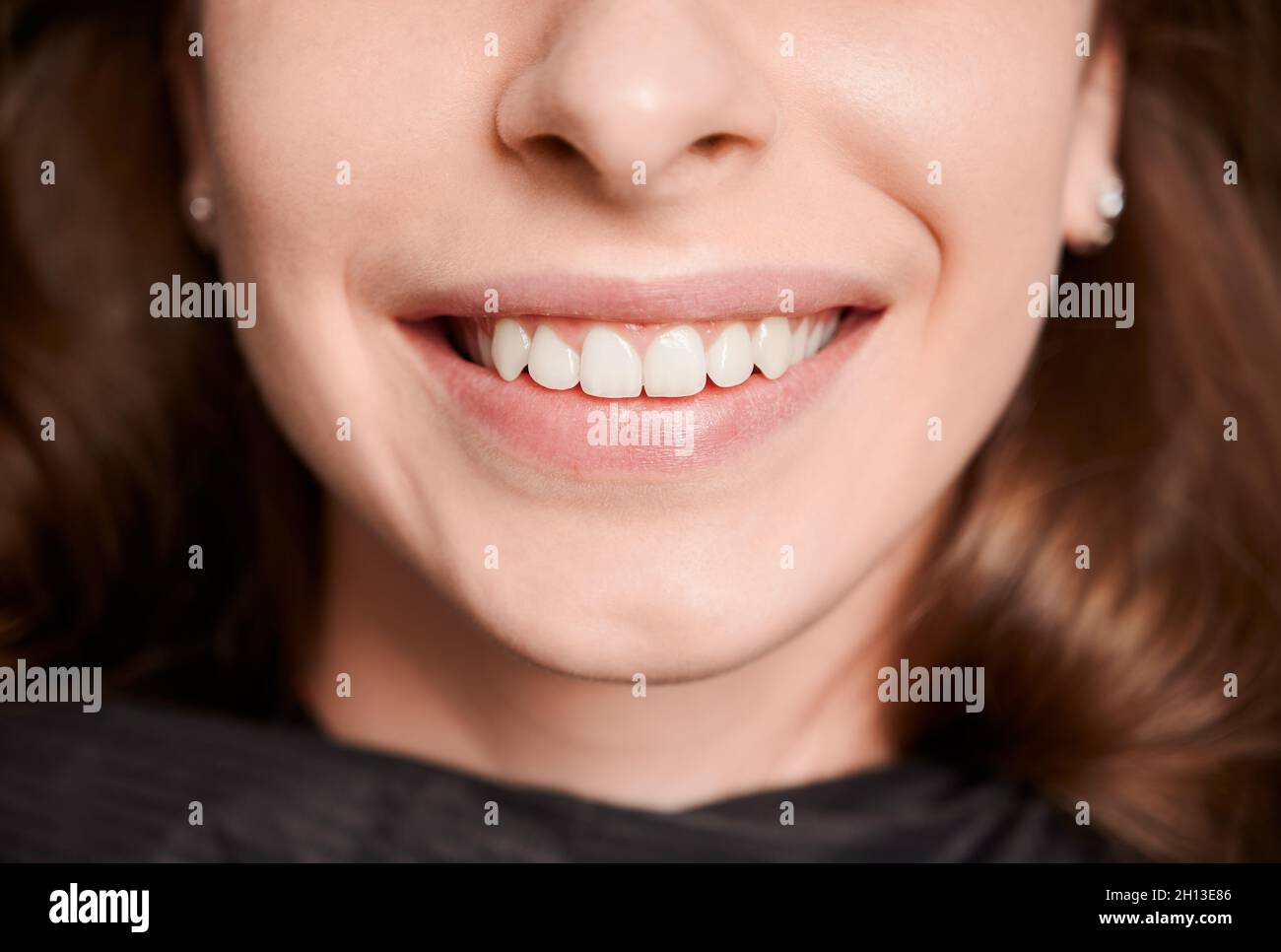 Close-up, cropped snapshot of beautiful healthy female smile. Front ...