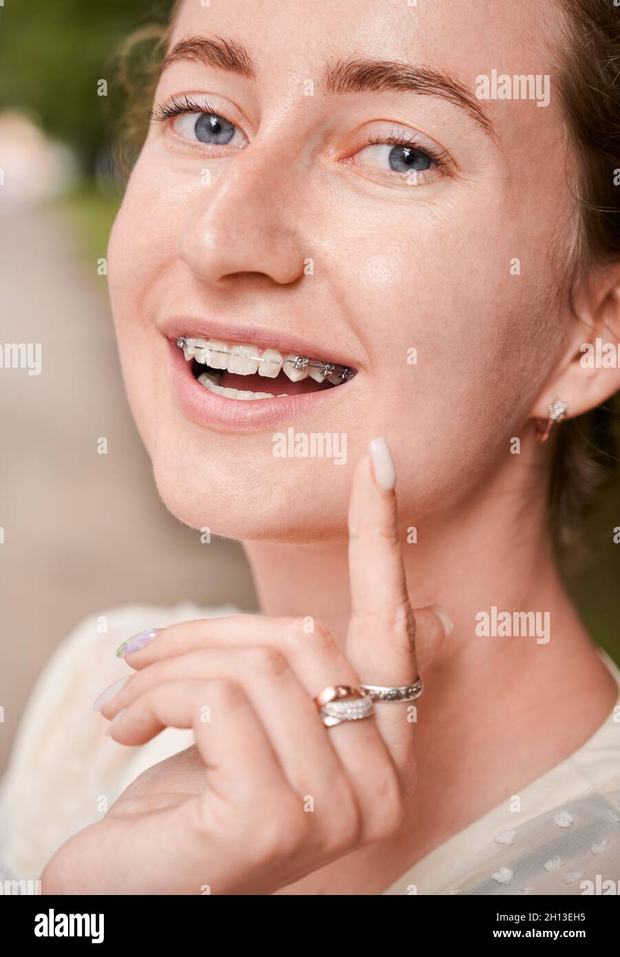 Close up of young woman pointing at orthodontic brackets on teeth ...
