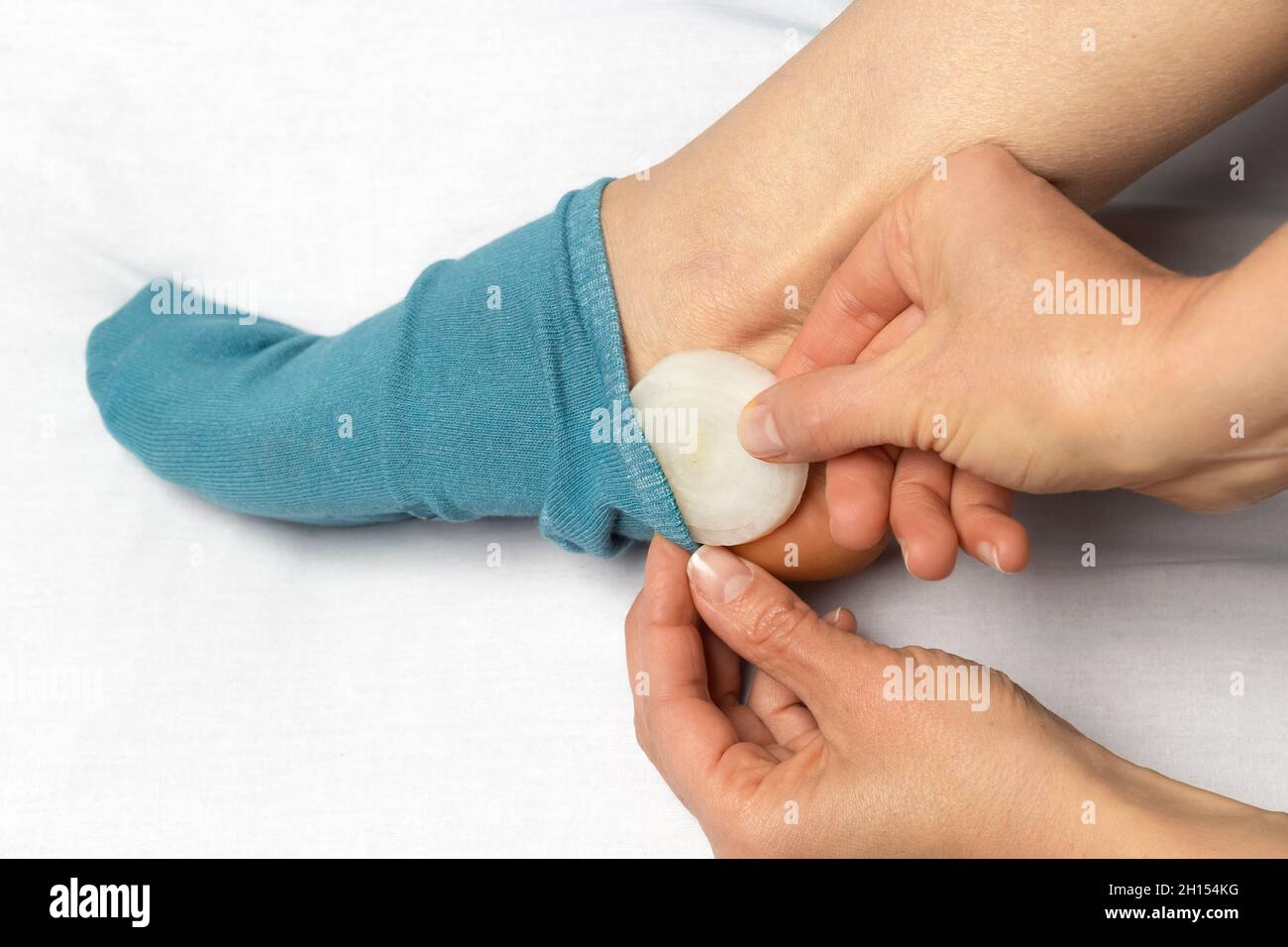 Onions on the feet in socks for the common cold Stock Photo - Alamy