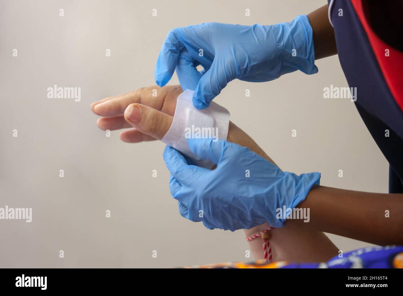 Caucasian woman with broken hands African nurse removing the cast Stock ...