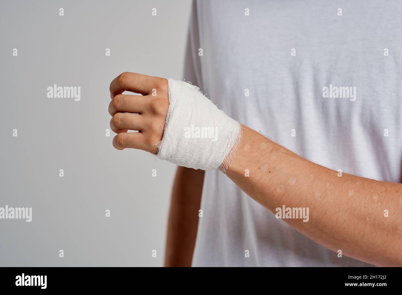 bandaged arm health problems pain injury Stock Photo - Alamy